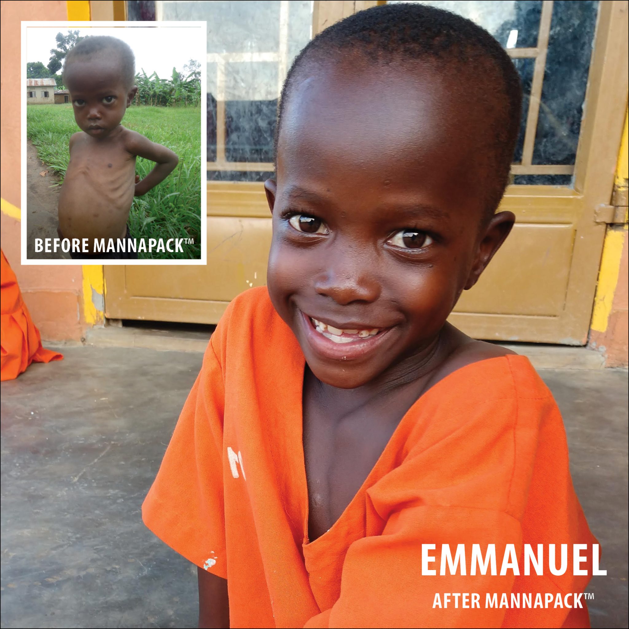 FMSC Pottstown MobilePack™ – Mobile Pack FMSC